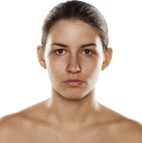 Face Gym Facial | Treatment | The Éterne Clinic